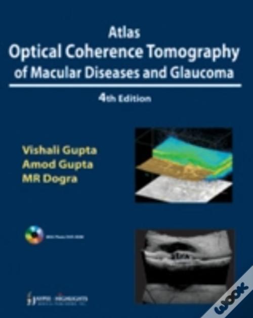 Atlas Optical Coherence Tomography Of Macular Diseases And Glaucoma de ...