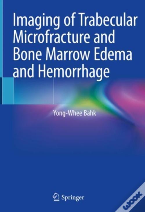 Imaging Of Trabecular Microfracture And Bone Marrow Edema And ...